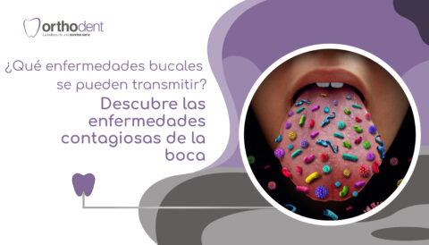 ¿Qué enfermedades bucales se pueden transmitir? Descubre las ...