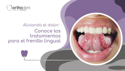 Aliviando el dolor: Conoce los tratamientos para el frenillo lingual ...
