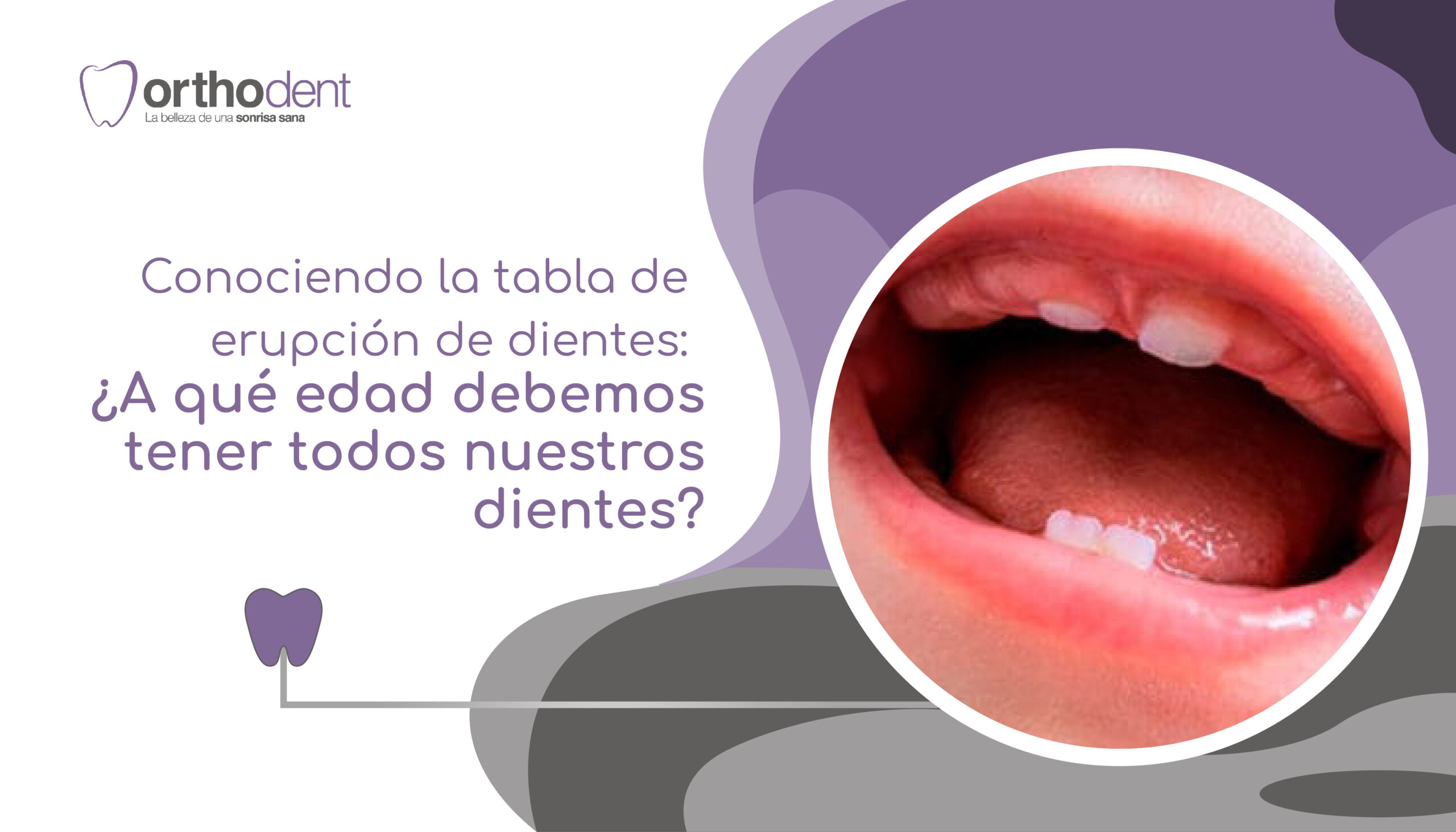 ¿A qué edad tenemos todos los dientes? - Orthodent