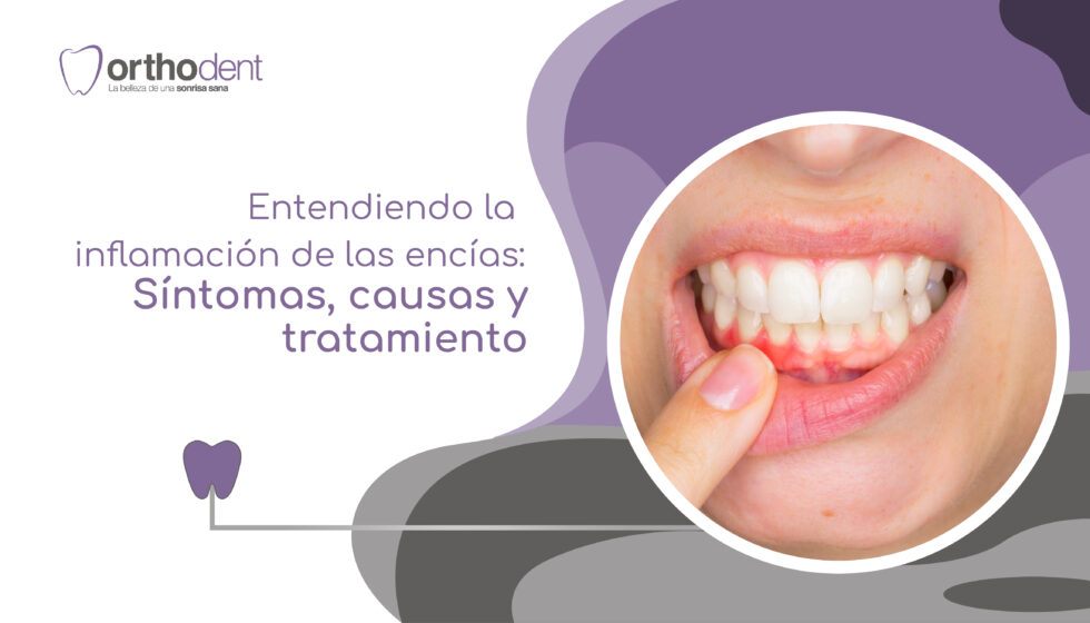 Entendiendo la inflamación de las encías: Síntomas, causas y ...