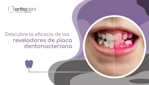Descubre la eficacia de los reveladores de placa dentobacteriana ...