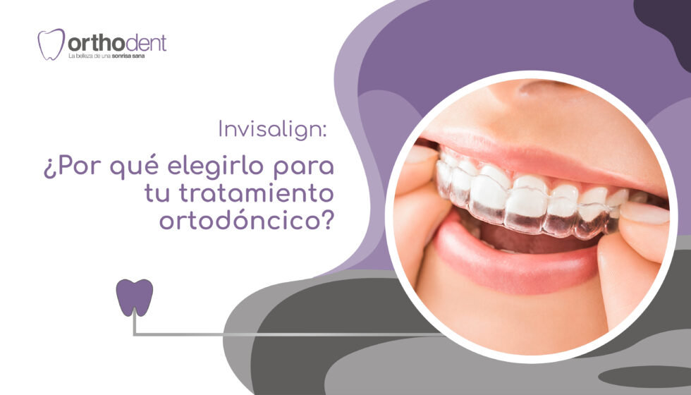 Invisalign: ¿Por qué elegirlo para tu tratamiento ortodóncico? - Orthodent