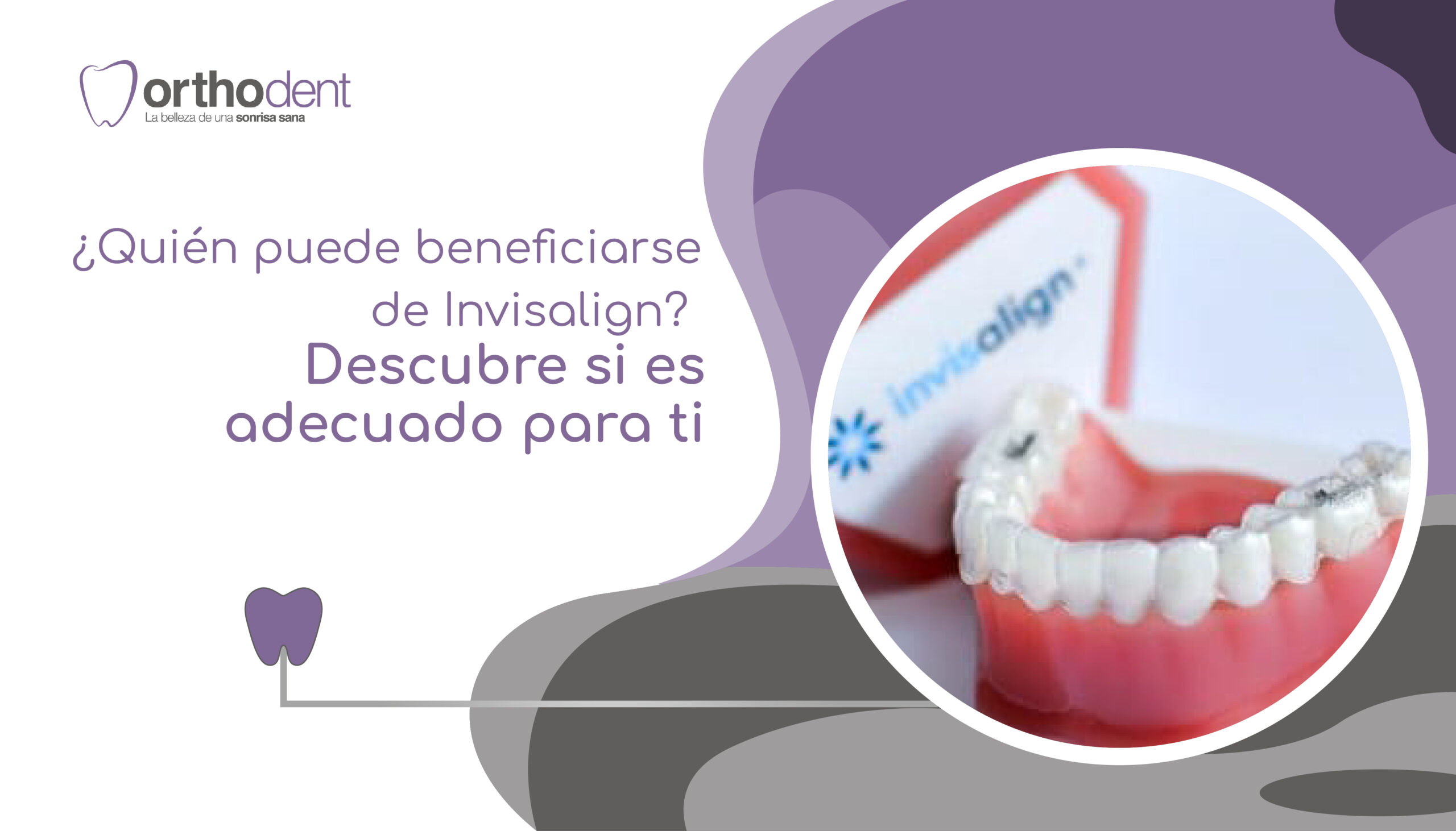¿Quién puede beneficiarse de Invisalign? Descubre si es adecuado para ...