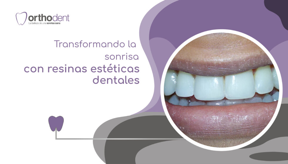 Transformando la sonrisa con resinas estéticas dentales - Orthodent